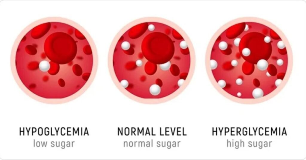 What is hyperglycemia: Causes, Symptoms and Home Remedies for Diabetes ...